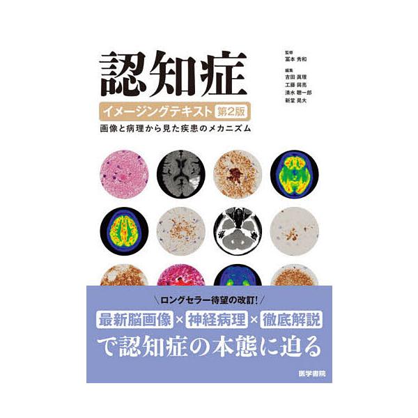 ※商品画像はイメージや仮デザインが含まれている場合があります。帯の有無など実際と異なる場合があります。監修:冨本秀和　ほか編集:吉田眞理出版社:医学書院発売日:2026年05月キーワード:認知症イメージングテキスト画像と病理から見た疾患のメ...