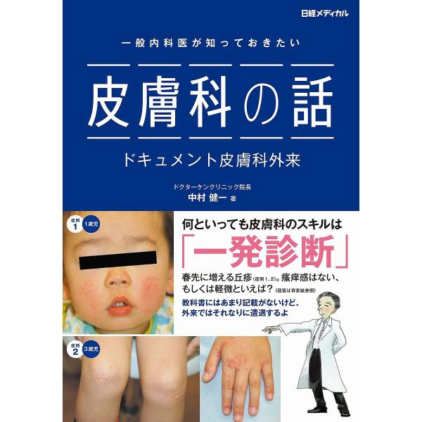 ※商品画像はイメージや仮デザインが含まれている場合があります。帯の有無など実際と異なる場合があります。著:中村健一　編集:日経メディカル出版社:日経BP発売日:2022年04月キーワード:一般内科医が知っておきたい皮膚科の話ドキュメント皮膚...