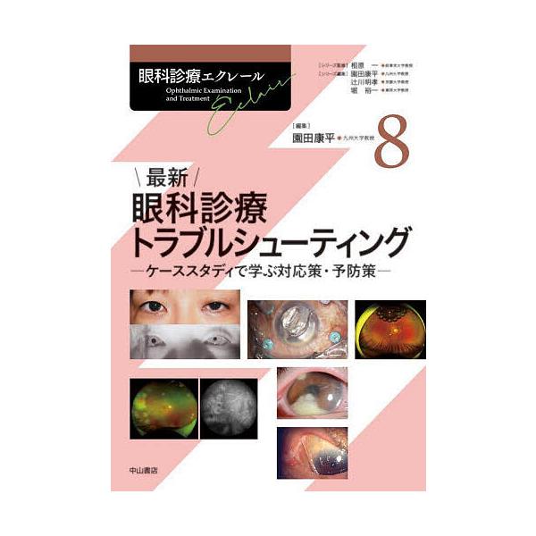 ※商品画像はイメージや仮デザインが含まれている場合があります。帯の有無など実際と異なる場合があります。シリーズ監修:相原一　シリーズ編集:園田康平　シリーズ編集:辻川明孝出版社:中山書店発売日:2025年05月巻数:8巻キーワード:眼科診療...