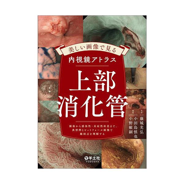 ※商品画像はイメージや仮デザインが含まれている場合があります。帯の有無など実際と異なる場合があります。監修:藤城光弘　編集:小田島慎也　編集:小野敏嗣出版社:羊土社発売日:2024年11月キーワード:美しい画像で見る内視鏡アトラス上部消化管...