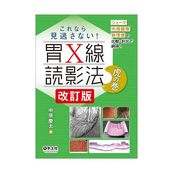 ※商品画像はイメージや仮デザインが含まれている場合があります。帯の有無など実際と異なる場合があります。著:中原慶太出版社:羊土社発売日:2025年11月キーワード:これなら見逃さない！胃X線読影法虎の巻シェーマ内視鏡像病理像の比較・対比で納...