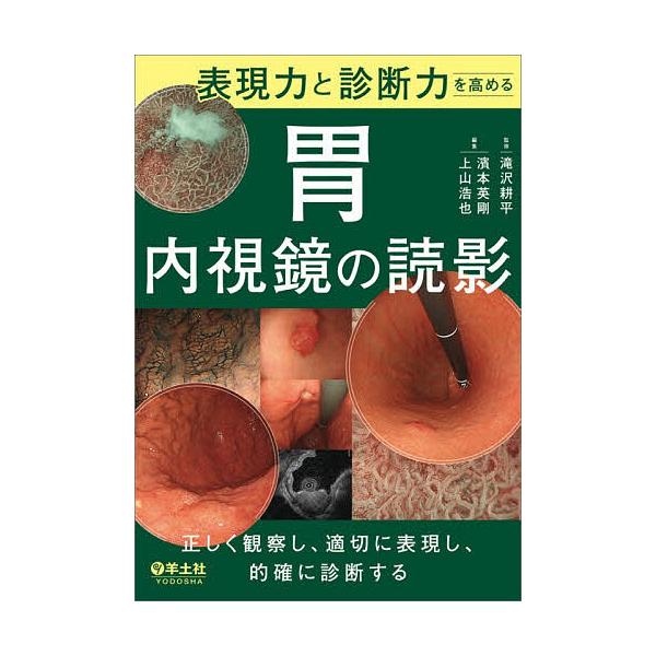 ※商品画像はイメージや仮デザインが含まれている場合があります。帯の有無など実際と異なる場合があります。監修:滝沢耕平　編集:濱本英剛　編集:上山浩也出版社:羊土社発売日:2025年11月キーワード:表現力と診断力を高める胃内視鏡の読影正しく...