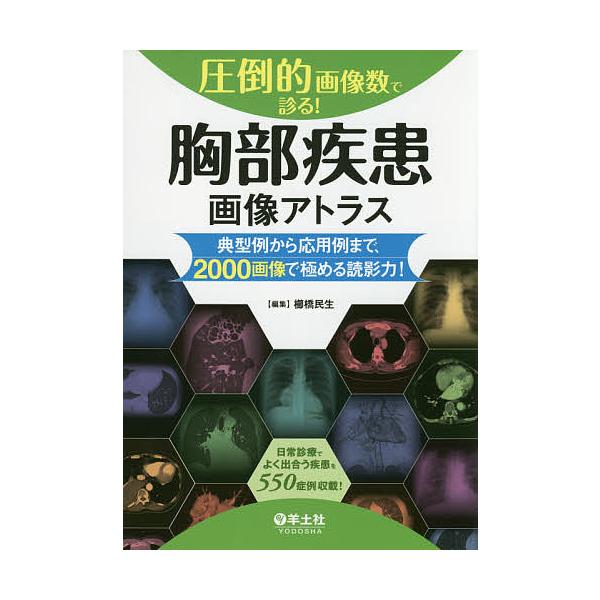 ※商品画像はイメージや仮デザインが含まれている場合があります。帯の有無など実際と異なる場合があります。編集:櫛橋民生出版社:羊土社発売日:2016年05月キーワード:圧倒的画像数で診る！胸部疾患画像アトラス典型例から応用例まで、２０００画像...