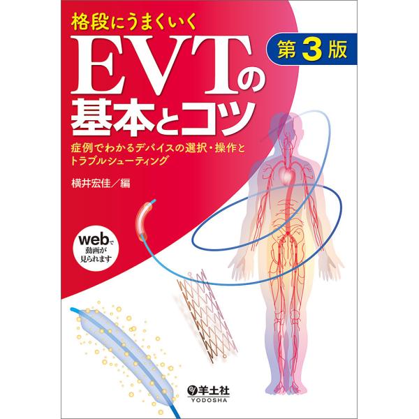 ※商品画像はイメージや仮デザインが含まれている場合があります。帯の有無など実際と異なる場合があります。編:横井宏佳出版社:羊土社発売日:2023年08月キーワード:格段にうまくいくEVTの基本とコツ症例でわかるデバイスの選択・操作とトラブル...