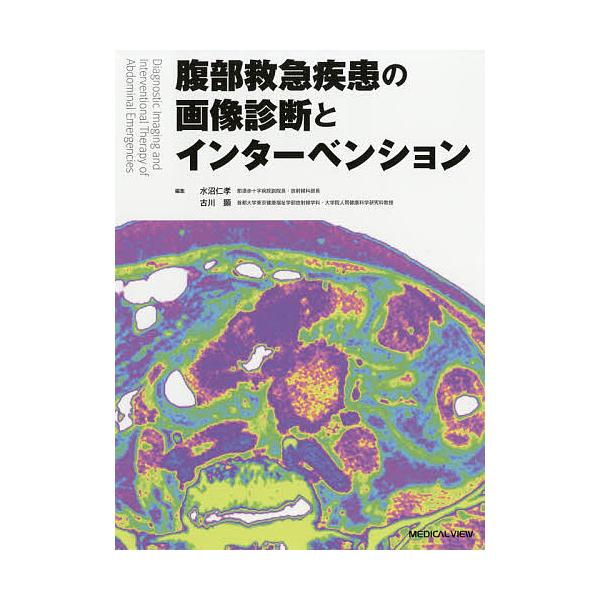 ※商品画像はイメージや仮デザインが含まれている場合があります。帯の有無など実際と異なる場合があります。編集:水沼仁孝　編集:古川顕出版社:メジカルビュー社発売日:2018年03月キーワード:腹部救急疾患の画像診断とインターベンション水沼仁孝...