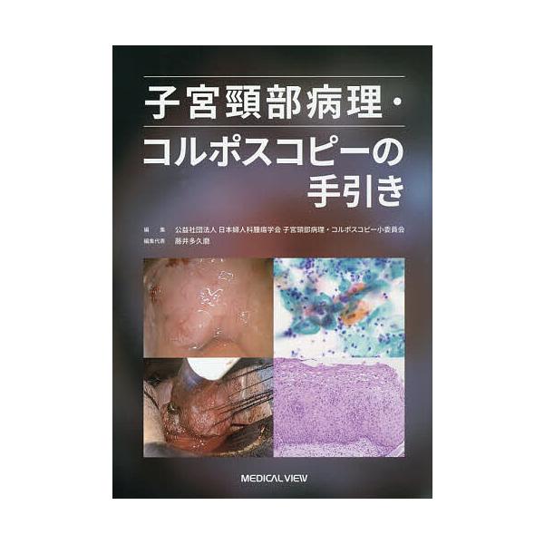 ※商品画像はイメージや仮デザインが含まれている場合があります。帯の有無など実際と異なる場合があります。編集:日本婦人科腫瘍学会子宮頸部病理・コルポスコピー小委員会　編集:藤井多久磨出版社:メジカルビュー社発売日:2026年05月キーワード:...