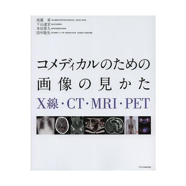 ※商品画像はイメージや仮デザインが含まれている場合があります。帯の有無など実際と異なる場合があります。著:後藤昇　著:下山達宏　著:本田晋久出版社:エクスナレッジ発売日:2013年08月キーワード:コメディカルのための画像の見かたX線・CT...