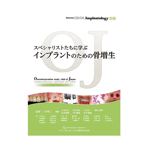監修:三好敬三　編集:寺本昌司　編集:岩田光弘出版社:クインテッセンス出版発売日:2018年02月シリーズ名等:Quintessence DENTAL Implantology別冊 オッセオインテグレイション・スタディクラブ・オブ・ジャパン...