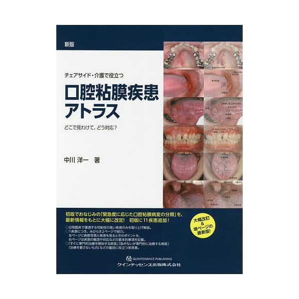 ※商品画像はイメージや仮デザインが含まれている場合があります。帯の有無など実際と異なる場合があります。著:中川洋一出版社:クインテッセンス出版発売日:2018年09月キーワード:チェアサイド・介護で役立つ口腔粘膜疾患アトラスどこで見わけて、...