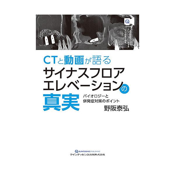 ※商品画像はイメージや仮デザインが含まれている場合があります。帯の有無など実際と異なる場合があります。著:野阪泰弘出版社:クインテッセンス出版発売日:2018年09月キーワード:CTと動画が語るサイナスフロアエレベーションの真実バイオロジー...