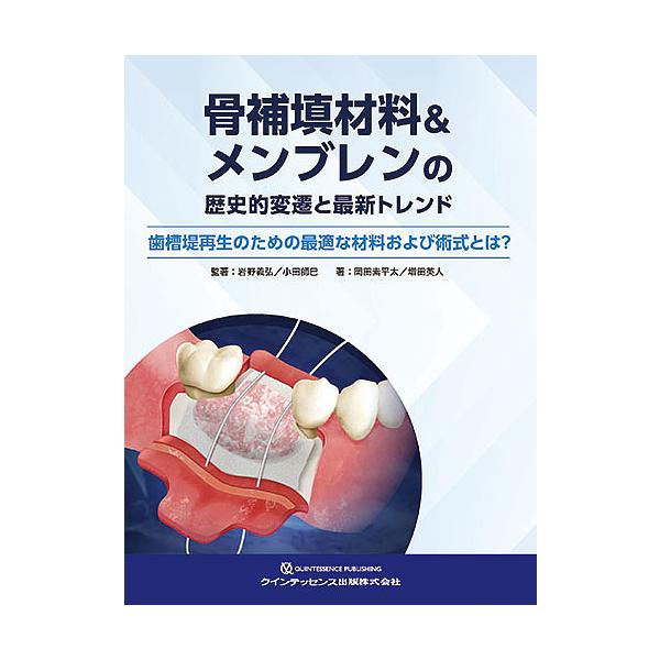 ※商品画像はイメージや仮デザインが含まれている場合があります。帯の有無など実際と異なる場合があります。監:岩野義弘　監:著小田師巳　著:著岡田素平太出版社:クインテッセンス出版発売日:2019年03月キーワード:骨補填材料＆メンブレンの歴史...