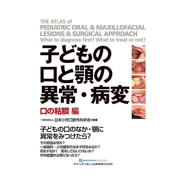 ※商品画像はイメージや仮デザインが含まれている場合があります。帯の有無など実際と異なる場合があります。編著:日本小児口腔外科学会出版社:クインテッセンス出版発売日:2019年08月キーワード:子どもの口と顎の異常・病変口の粘膜編日本小児口腔...