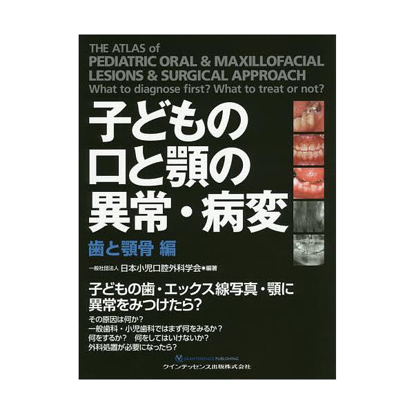 ※商品画像はイメージや仮デザインが含まれている場合があります。帯の有無など実際と異なる場合があります。編著:日本小児口腔外科学会出版社:クインテッセンス出版発売日:2019年11月キーワード:子どもの口と顎の異常・病変歯と顎骨編日本小児口腔...