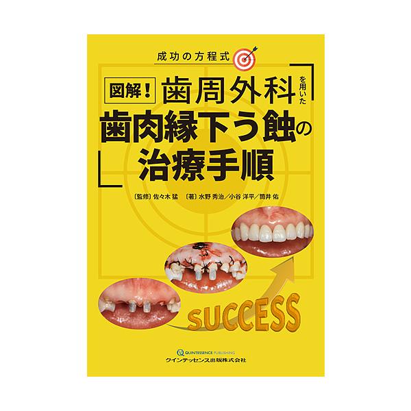 ※商品画像はイメージや仮デザインが含まれている場合があります。帯の有無など実際と異なる場合があります。監修:佐々木猛　著:水野秀治　著:小谷洋平出版社:クインテッセンス出版発売日:2019年12月キーワード:図解！歯周外科を用いた歯肉縁下う...