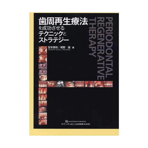 ※商品画像はイメージや仮デザインが含まれている場合があります。帯の有無など実際と異なる場合があります。著:宮本泰和　著:尾野誠出版社:クインテッセンス出版発売日:2020年06月キーワード:歯周再生療法を成功させるテクニックとストラテジー宮...