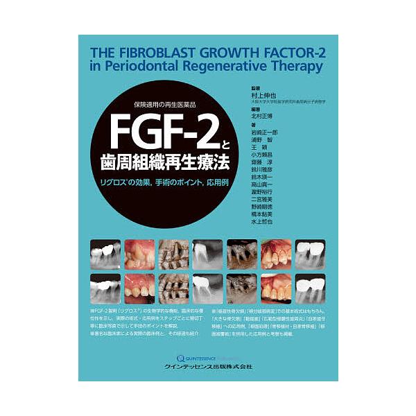 監:村上伸也　編著:著北村正博　ほか著:岩崎正一郎出版社:クインテッセンス出版発売日:2020年08月キーワード:FGF−２と歯周組織再生療法リグロスの効果，手術のポイント，応用例保険適用の再生医薬品村上伸也著北村正博岩崎正一郎 えふじーえ...