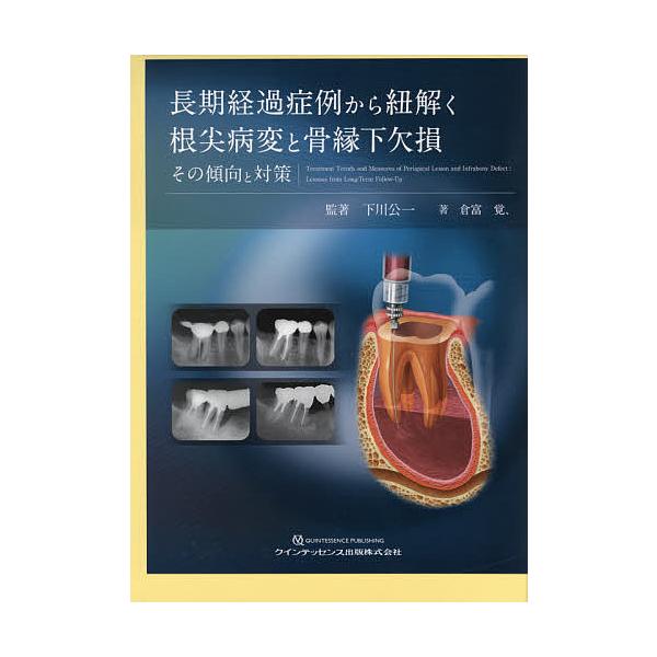 監:下川公一　著:著倉富覚、出版社:クインテッセンス出版発売日:2021年02月キーワード:長期経過症例から紐解く根尖病変と骨縁下欠損その傾向と対策下川公一著倉富覚、 ちようきけいかしようれいからひもとくこんせんびよう チヨウキケイカシヨウ...
