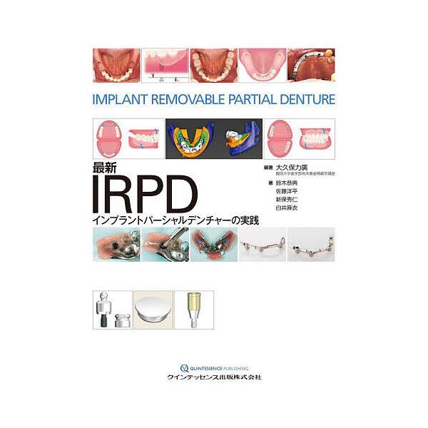 ※商品画像はイメージや仮デザインが含まれている場合があります。帯の有無など実際と異なる場合があります。編著:大久保力廣　著:鈴木恭典　著:佐藤洋平出版社:クインテッセンス出版発売日:2022年11月キーワード:最新IRPDインプラントパーシ...