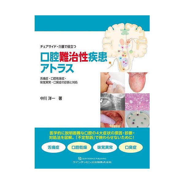 ※商品画像はイメージや仮デザインが含まれている場合があります。帯の有無など実際と異なる場合があります。著:中川洋一出版社:クインテッセンス出版発売日:2024年08月キーワード:チェアサイド・介護で役立つ口腔難治性疾患アトラス舌痛症・口腔乾...