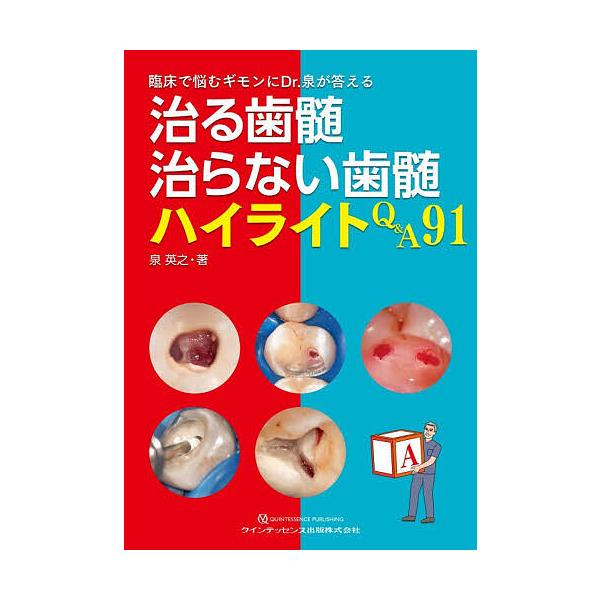 ※商品画像はイメージや仮デザインが含まれている場合があります。帯の有無など実際と異なる場合があります。著:泉英之出版社:クインテッセンス出版発売日:2025年11月キーワード:治る歯髄治らない歯髄ハイライトQ＆A９１臨床で悩むギモンにDr．...
