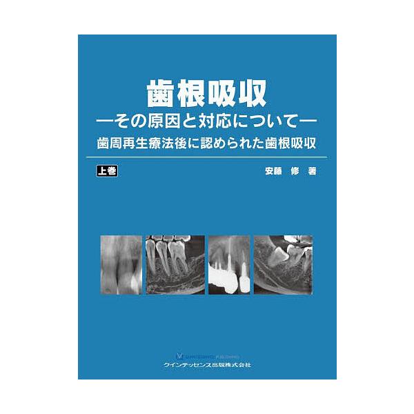 ※商品画像はイメージや仮デザインが含まれている場合があります。帯の有無など実際と異なる場合があります。著:安藤修出版社:クインテッセンス出版発売日:2026年09月キーワード:歯根吸収その原因と対応について上巻歯周再生療法後に認められた歯根...