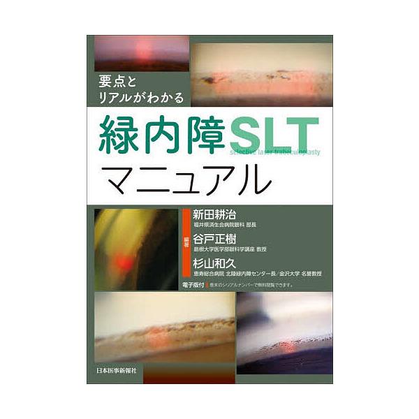 ※商品画像はイメージや仮デザインが含まれている場合があります。帯の有無など実際と異なる場合があります。編著:新田耕治　編著:谷戸正樹　編著:杉山和久出版社:日本医事新報社発売日:2026年04月キーワード:要点とリアルがわかる緑内障SLTマ...