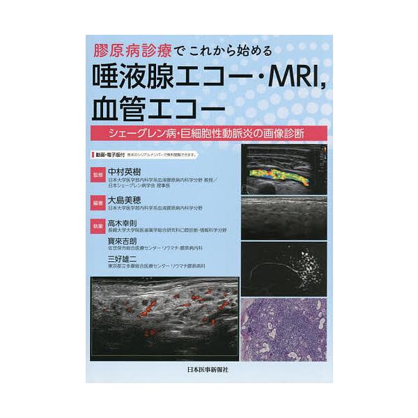 ※商品画像はイメージや仮デザインが含まれている場合があります。帯の有無など実際と異なる場合があります。監修:中村英樹　編著:大島美穂　執筆:高木幸則出版社:日本医事新報社発売日:2026年10月キーワード:膠原病診療でこれから始める唾液腺エ...