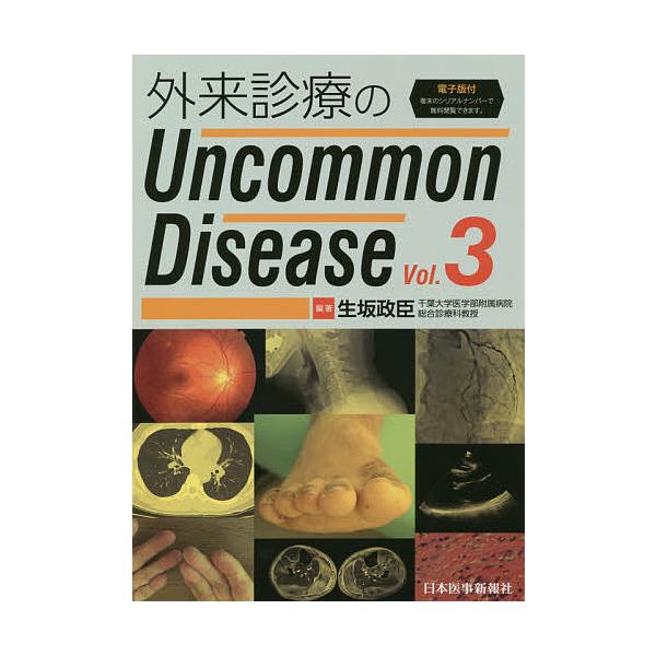 ※商品画像はイメージや仮デザインが含まれている場合があります。帯の有無など実際と異なる場合があります。編著:生坂政臣出版社:日本医事新報社発売日:2020年11月巻数:3巻キーワード:外来診療のUncommonDiseaseVol．３生坂政...