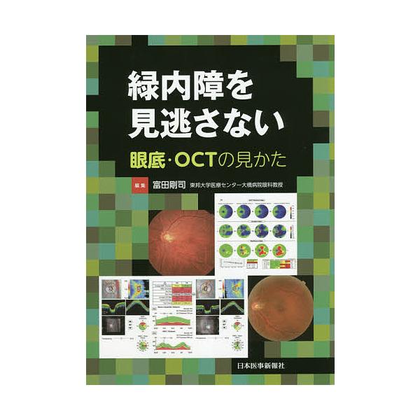 編集:富田剛司出版社:日本医事新報社発売日:2018年02月キーワード:緑内障を見逃さない眼底・OCTの見かた富田剛司 りよくないしようおみのがさないがんていおーしーてい リヨクナイシヨウオミノガサナイガンテイオーシーテイ とみた ごうじ ...