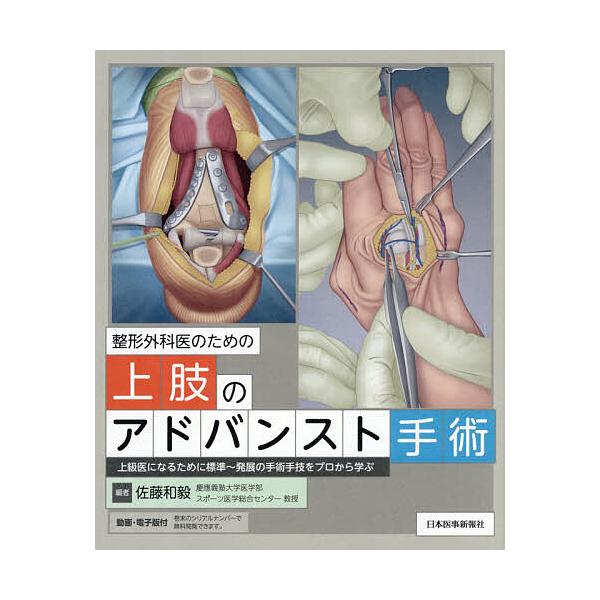 ※商品画像はイメージや仮デザインが含まれている場合があります。帯の有無など実際と異なる場合があります。編:佐藤和毅出版社:日本医事新報社発売日:2026年03月キーワード:整形外科医のための上肢のアドバンスト手術佐藤和毅 せいけいげかいのた...