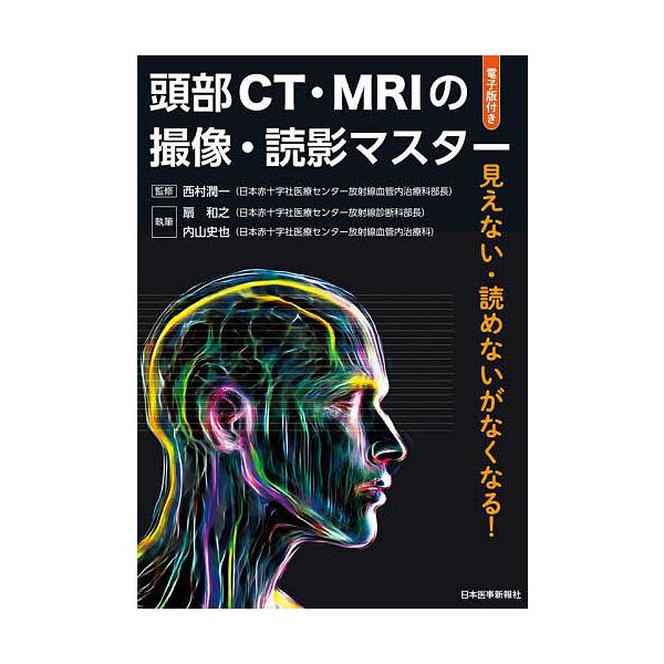 監修:西村潤一　執筆:扇和之　執筆:内山史也出版社:日本医事新報社発売日:2025年03月キーワード:頭部CT・MRIの撮像・読影マスター見えない・読めないがなくなる！西村潤一扇和之内山史也 とうぶしーていーえむあーるあいのさつぞうどくえい...