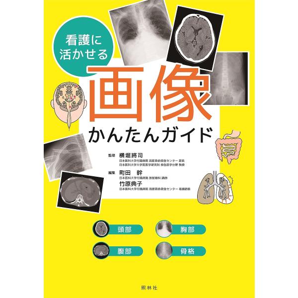 監修:横堀將司　編集:町田幹　編集:竹原典子出版社:照林社発売日:2023年09月キーワード:看護に活かせる画像かんたんガイド横堀將司町田幹竹原典子 かんごにいかせるがぞうかんたんがいど カンゴニイカセルガゾウカンタンガイド よこぼり しよ...