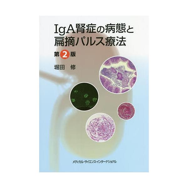 ※商品画像はイメージや仮デザインが含まれている場合があります。帯の有無など実際と異なる場合があります。著:堀田修出版社:メディカル・サイエンス・インターナショナル発売日:2022年01月キーワード:IgA腎症の病態と扁摘パルス療法堀田修 あ...