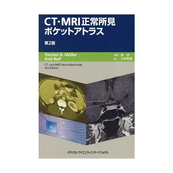 ※商品画像はイメージや仮デザインが含まれている場合があります。帯の有無など実際と異なる場合があります。著:TorstenB．Moller　著:EmilReif　監訳:南学出版社:メディカル・サイエンス・インターナショナル発売日:2025年0...