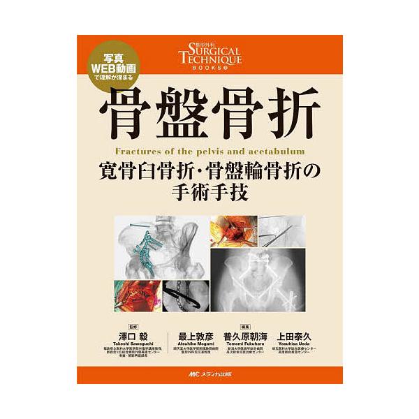 ※商品画像はイメージや仮デザインが含まれている場合があります。帯の有無など実際と異なる場合があります。監修:澤口毅　編集:最上敦彦　編集:普久原朝海出版社:メディカ出版発売日:2022年07月シリーズ名等:整形外科SURGICAL TECH...