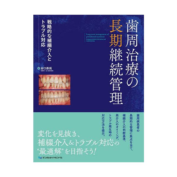 ※商品画像はイメージや仮デザインが含まれている場合があります。帯の有無など実際と異なる場合があります。著:谷口崇拓出版社:デンタルダイヤモンド社発売日:2026年04月キーワード:歯周治療の長期継続管理戦略的な補綴介入とトラブル対応谷口崇拓...
