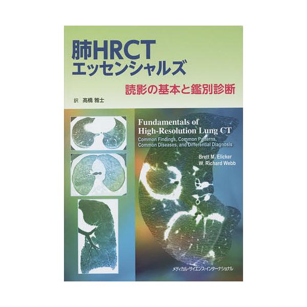 著:ブレットM．エリッカー　著:W．リチャードウェッブ　訳:高橋雅士出版社:メディカル・サイエンス・インターナショナル発売日:2014年09月キーワード:肺HRCTエッセンシャルズ読影の基本と鑑別診断ブレットM．エリッカーW．リチャードウェ...