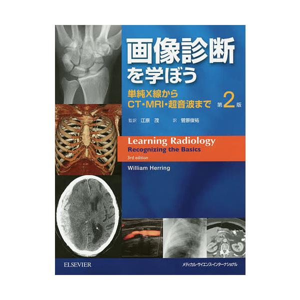※商品画像はイメージや仮デザインが含まれている場合があります。帯の有無など実際と異なる場合があります。著:ウィリアムヘリング　監訳:江原茂　訳:菅原俊祐出版社:エルゼビア・ジャパン発売日:2018年04月キーワード:画像診断を学ぼう単純X線...