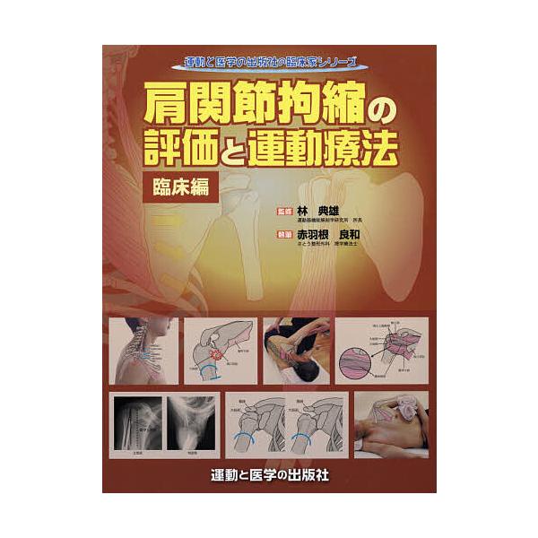 ※商品画像はイメージや仮デザインが含まれている場合があります。帯の有無など実際と異なる場合があります。監修:林典雄　執筆:赤羽根良和出版社:運動と医学の出版社発売日:2019年02月シリーズ名等:運動と医学の出版社の臨床家シリーズキーワード...