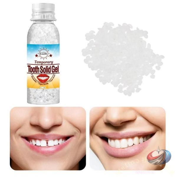 フィッティングビーズ、超便利、簡単操作。様々な形の歯を作ることができます。