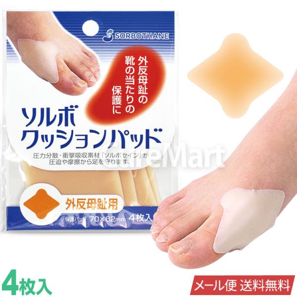 商品名：ソルボ クッションパッド 外反母趾用規格：4枚入(パッドサイズ：70×62mm)、カラー(オークル)品質：ポリウレタン樹脂(ソルボセイン)、粘着剤(アクリル系、低アレルギー性)使用方法：クッションパッドを台紙からゆっくりはがし、トラ...