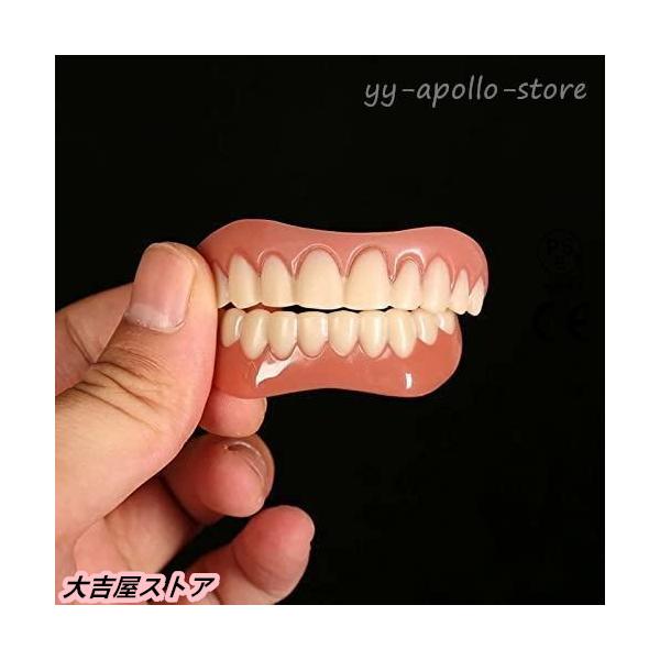 上顎と下顎の入れ歯2本で歯をすばやく固定し、自信に満ちた笑顔を取り戻します