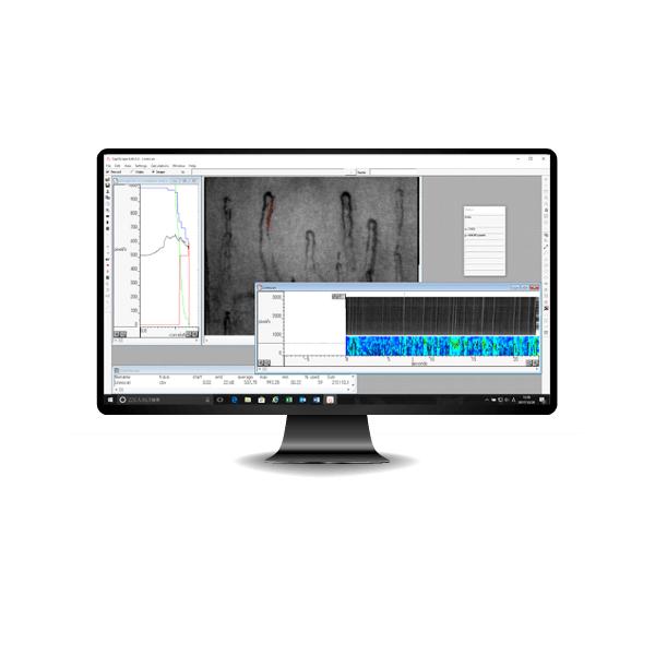 血管血流画像解析ソフト Capimetrics (Capillary metrics)●欧州の医療機器ソフトをカスタマイズ　ライセンス契約(130以上の論文有)●1秒間に60コマを取り込み正確な血流速度・血管の太さを解析可能。●国立研究所、...