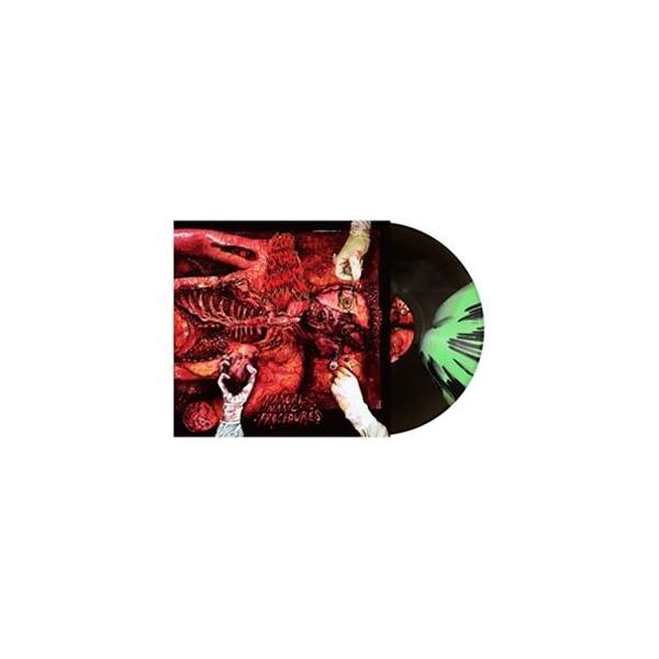 【発売日：2026年01月30日】種別:LP 【輸入盤】 洋楽ハードロック/ヘヴィメタル 発売日:2026/01/30 登録日:2024/11/01 200・スタブ・ウンズ マニュアル・マニク・プロシージャーズ（ナイトメア・フロスト・ヴァイ...