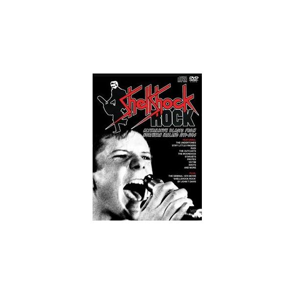 【発売日：2020年07月24日】種別:3CD＋DVD 【輸入盤】 洋楽ハードロック/ヘヴィメタル 発売日:2020/07/24 登録日:2020/07/17 ヴァリアス シェルショック・ロック：オルタナティブ・ブラスツ・フロム・ノーザン・...