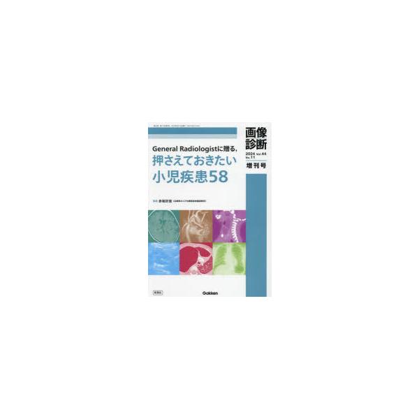 本 ISBN:9784055200714 赤坂好宣／編著 出版社:Gakken 出版年月:2024年09月 サイズ:160P 26cm 医学 ≫ 臨床医学一般 [ 画像診断・超音波診断学 ] ジエネラル ラジオロジスト ニ オクル オサエテ...