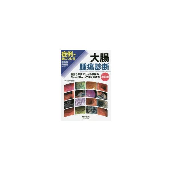 本 ISBN:9784758110532 田中信治／編集 出版社:羊土社 出版年月:2014年11月 サイズ:302P 26cm 医学 ≫ 臨床医学内科系 [ 消化器一般 ] ダイチヨウ シユヨウ シンダン ホウフ ナ シヤシン デ アガル...