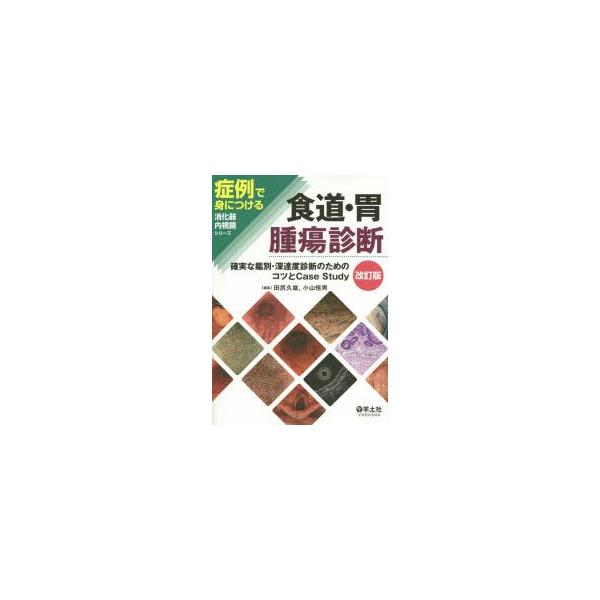 本 ISBN:9784758110563 田尻久雄／編集 小山恒男／編集 出版社:羊土社 出版年月:2015年06月 サイズ:398P 26cm 医学 ≫ 臨床医学一般 [ 癌・腫瘍一般 ] シヨクドウ イシユヨウ シンダン シヨクドウ イ...
