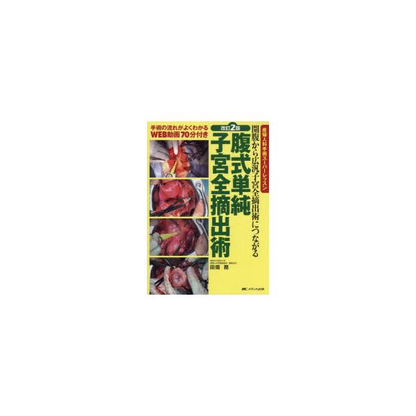 本 ISBN:9784840488150 田畑務／著 出版社:メディカ出版 出版年月:2025年06月 サイズ:125P 26cm 医学 ≫ 臨床医学外科系 [ 産婦人科学 ] フクシキ タンジユン シキユウ ゼンテキシユツジユツ フクシキ...