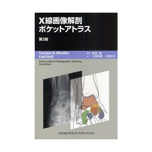本 ISBN:9784895926645 トルステン B.メーラー／著 エミール レイフ／〔著〕 町田徹／監訳 小林有香／訳 小塚拓洋／訳 出版社:メディカル・サイエンス・インターナショナル 出版年月:2011年02月 サイズ:392P 1...